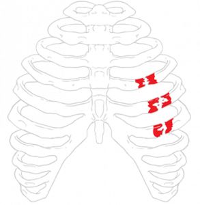 Rib Fracture - Neumark Lung & Chest Surgical Centre
