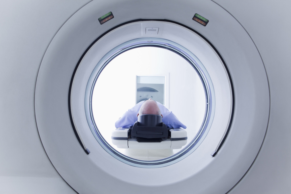 CT Scans for Chest Pain: Symptoms, Causes, and Solutions