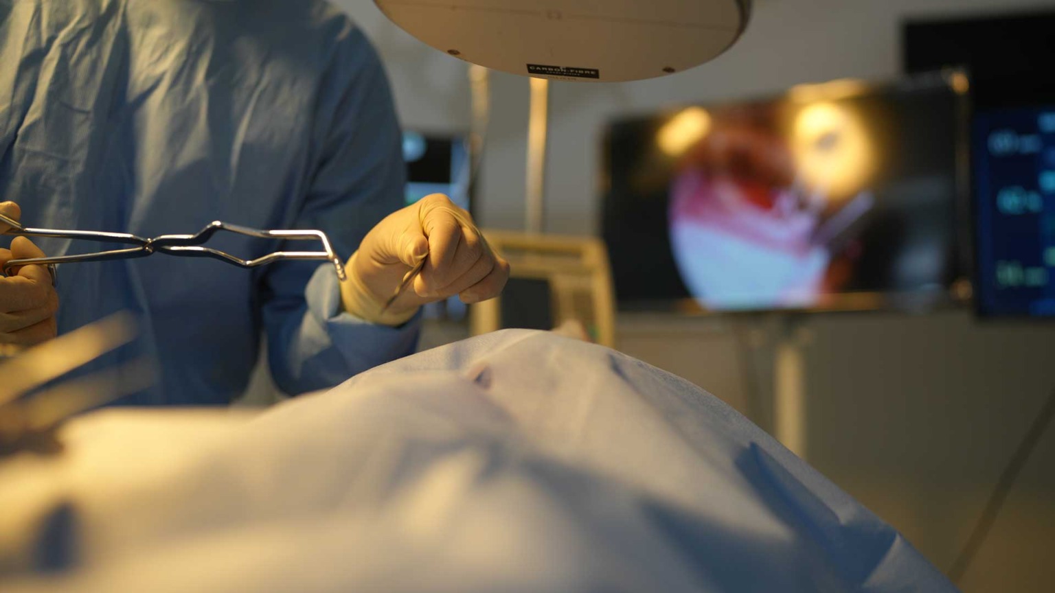 Closed Pneumothorax: Causes, Diagnosis, and Modern Treatment Approaches