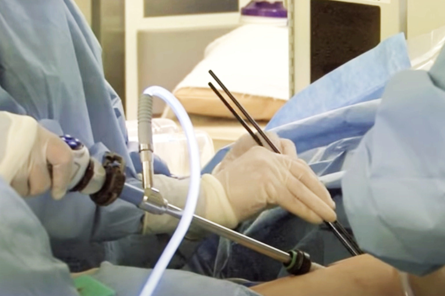 Minimally Invasive Thoracic Surgery: VATS vs RATS | Expert Guide by Dr ...