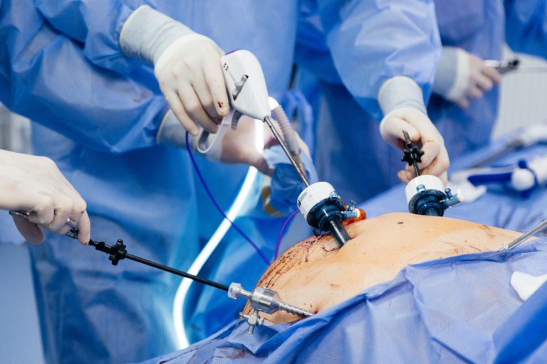 Broken Ribs Treatment: Expert Thoracic Surgery for Rib Fractures