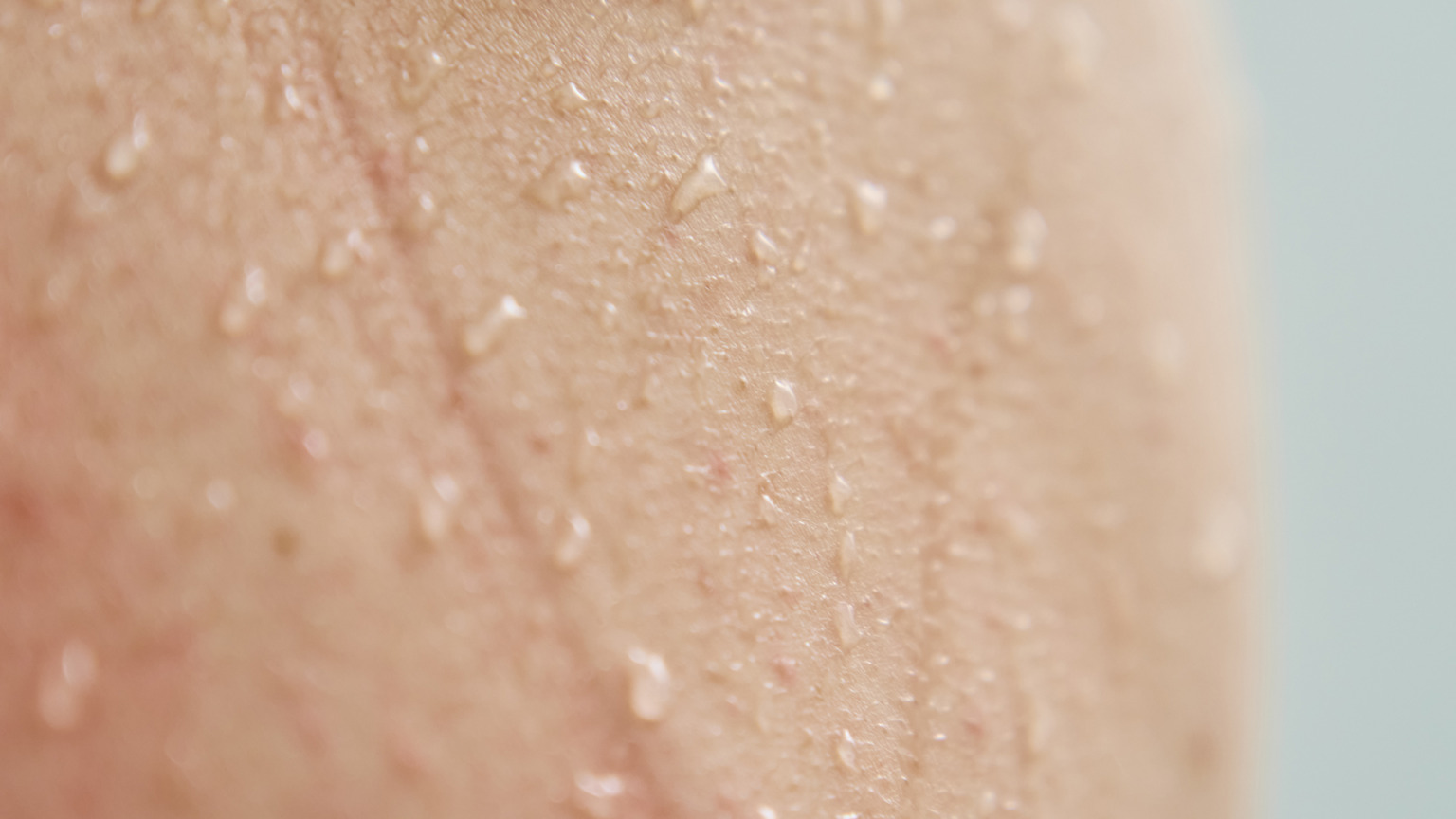 Hyperhidrosis Treatment in Singapore | Hyperhidrosis Surgery