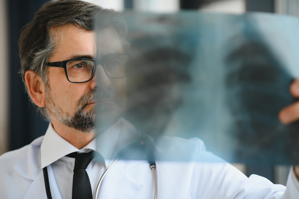 Lung Wedge Resection: Minimally Invasive Surgery for Early Lung Disease