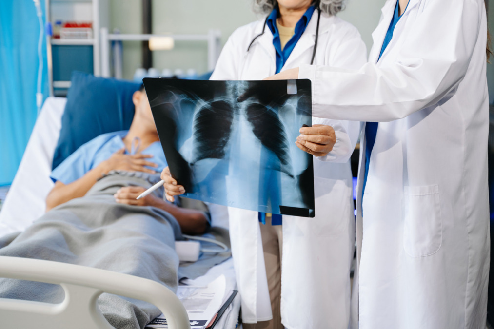 Lung Wedge Resection: Minimally Invasive Surgery for Early Lung Disease