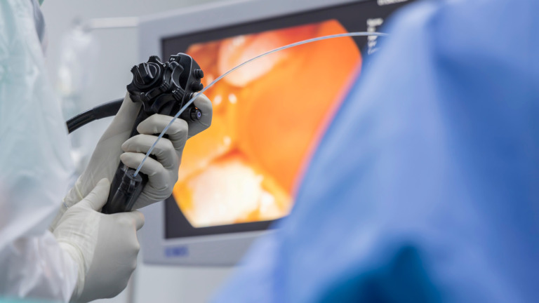 Types of Lung Surgery for Lung Cancer