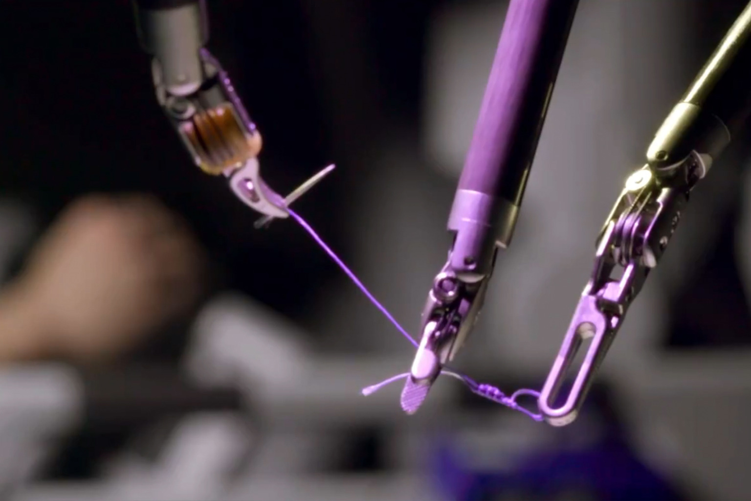 Minimally Invasive Thoracic Surgery: VATS vs RATS | Expert Guide by Dr ...